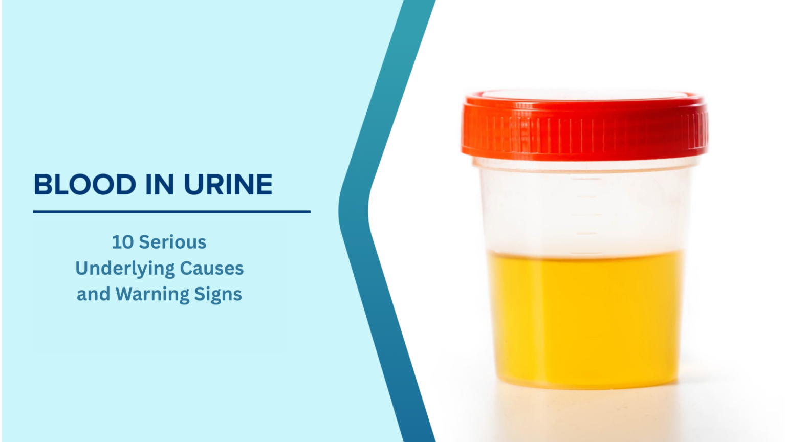 10 Serious Underlying Causes & Warning Signs of Blood in Urine